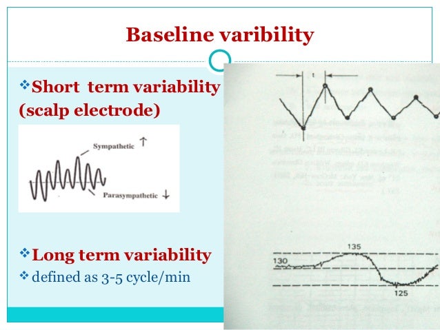 Fetal monitoring for undergraduate
