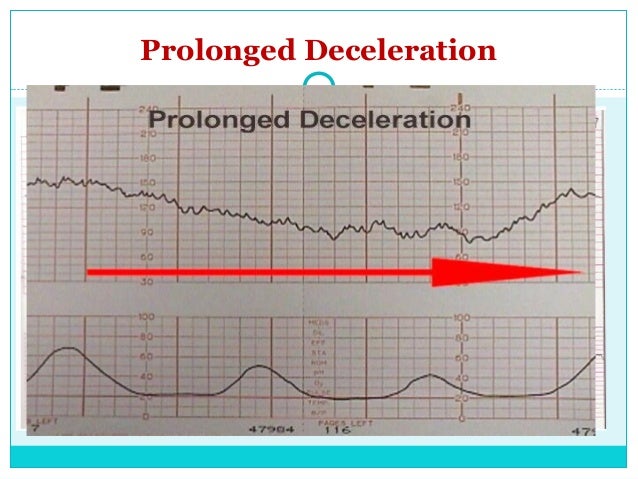 Fetal monitoring for undergraduate