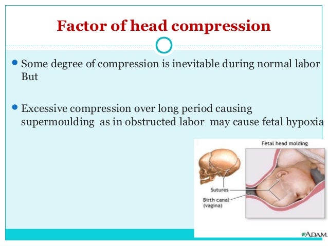 Fetal monitoring for undergraduate