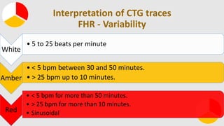 Fetal monitoring in labour obstetrics and gynecology | PDF