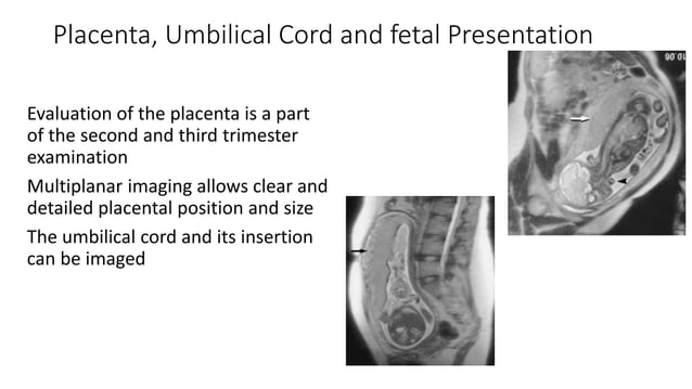 Fetal mri | PPTX | Pregnancy | Reproductive Health