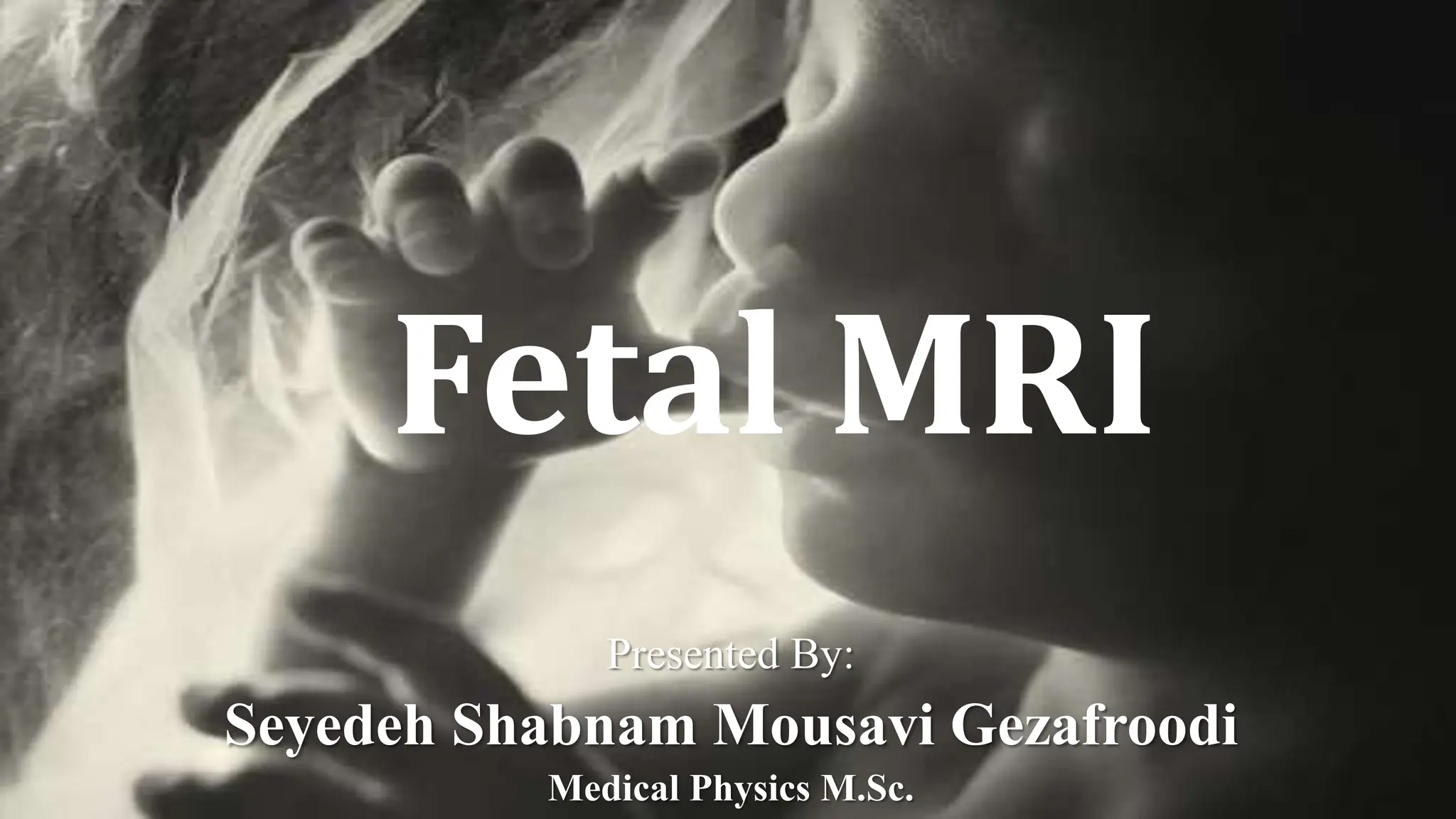 Fetal MRI.Shabnam.pptx- Physics, Techniques, Indication | PPTX