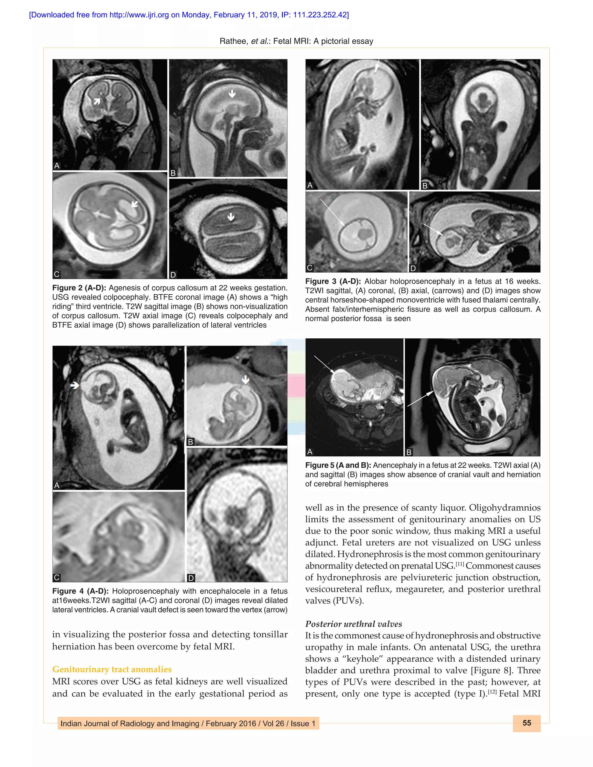 Fetal mri a pictorial essay | PDF