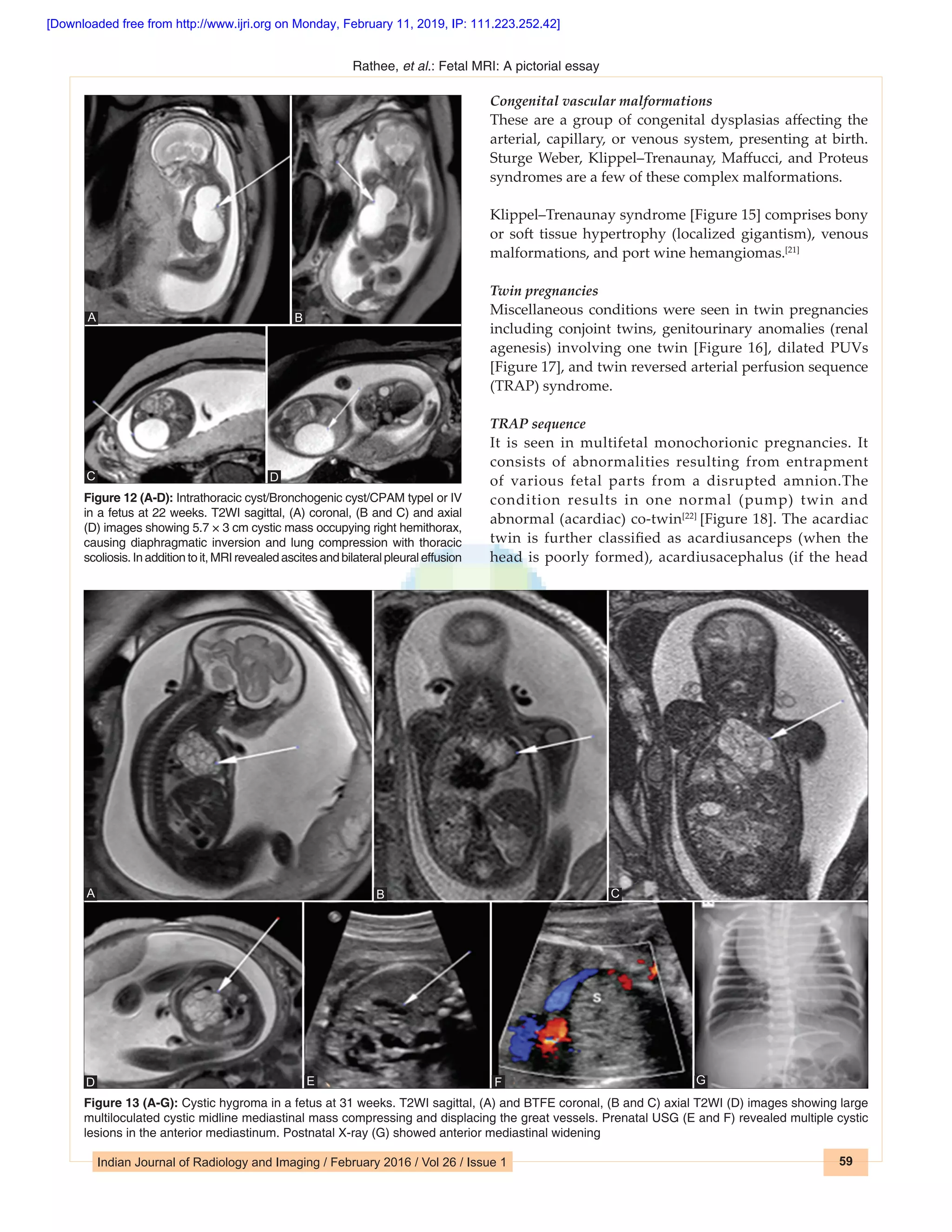 Fetal mri a pictorial essay | PDF