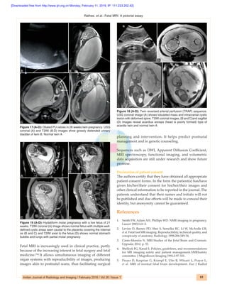Fetal mri a pictorial essay | PDF