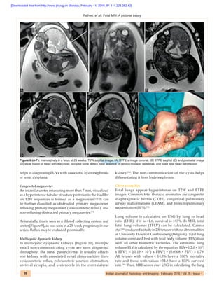 Fetal mri a pictorial essay | PDF