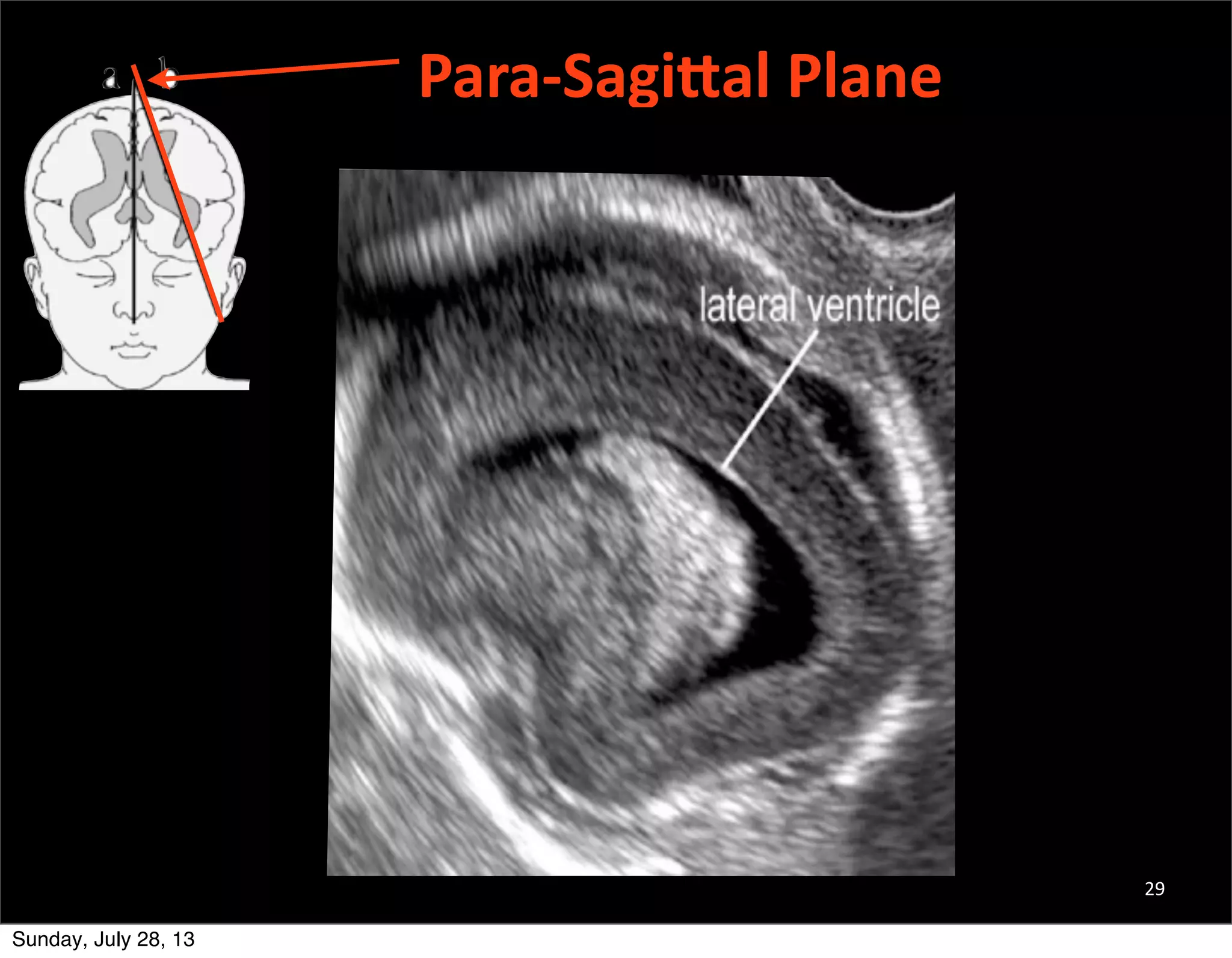 Fetal neurosonogram jucog feb 2013 | PDF | Pregnancy | Reproductive Health