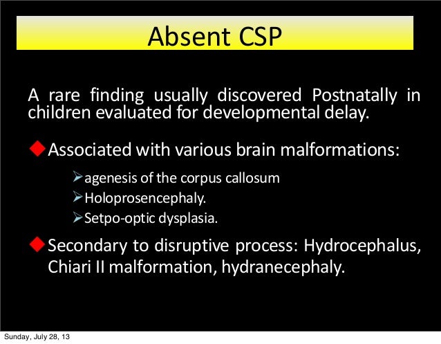 Fetal neurosonogram jucog feb 2013