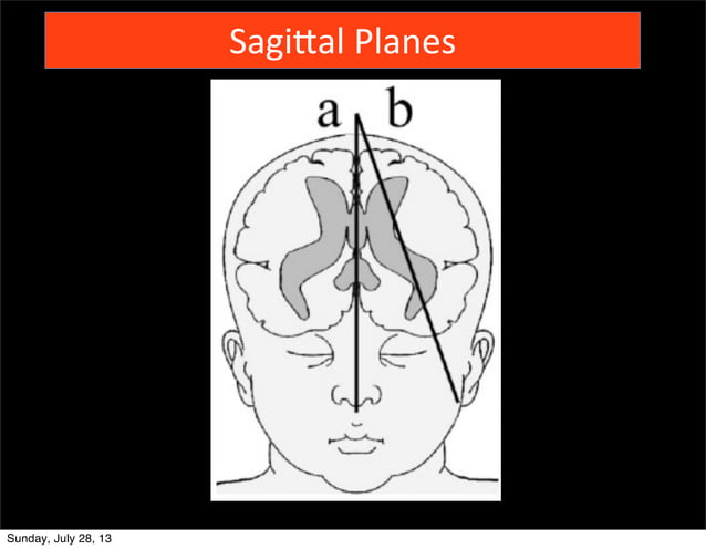 Fetal Neurosonogram | PDF