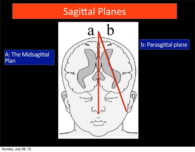 Fetal Neurosonogram | PDF