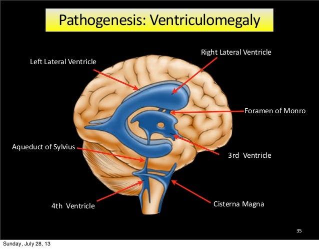 Fetal Neurosonogram