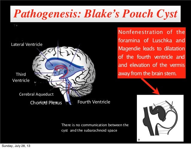 Fetal Neurosonogram