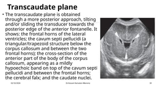 Fetal neurosonography Dr. Hossam Ramadan Alkeremy | PPTX