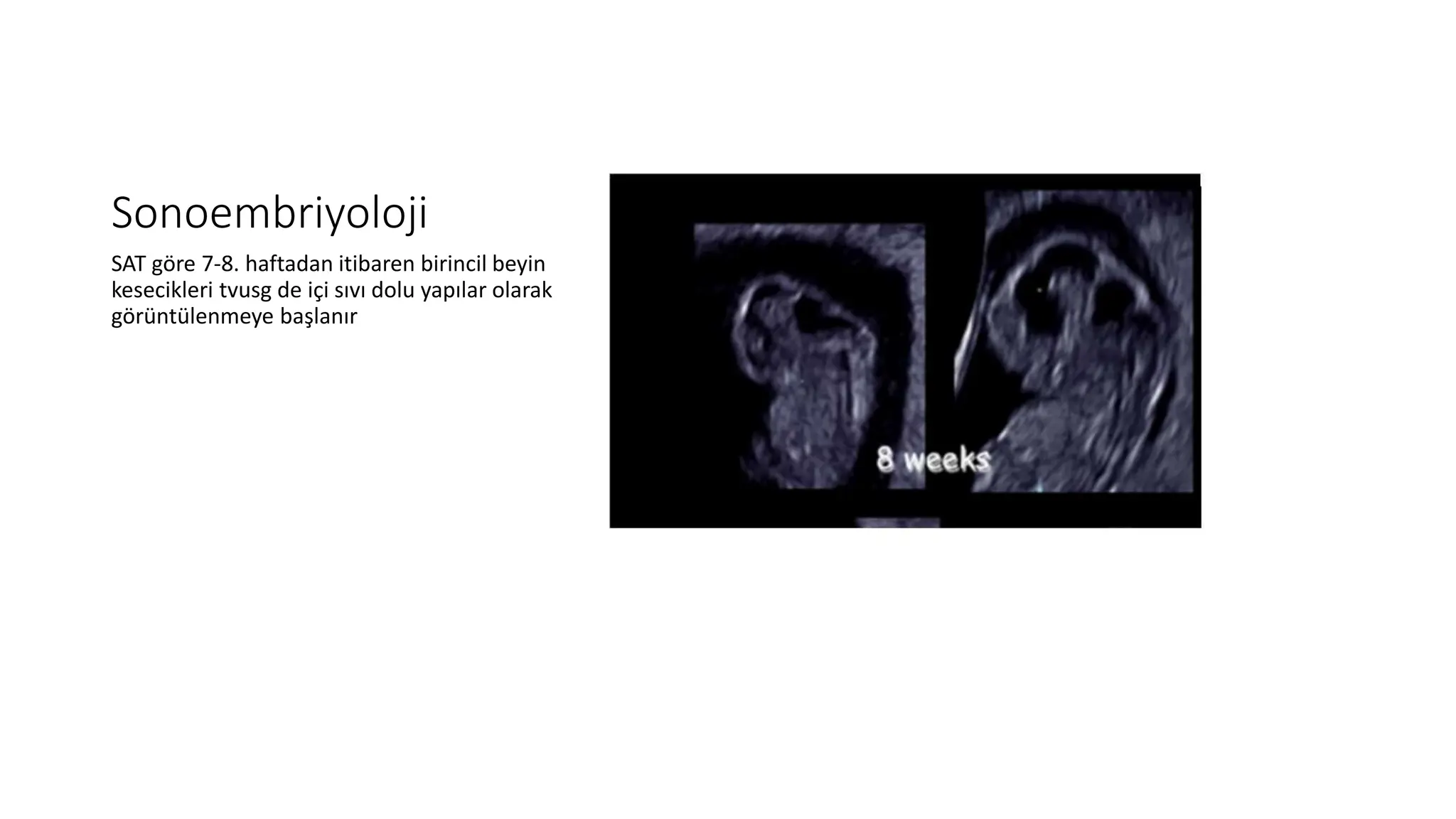 fetal merkezi sinir sistemi ultrasonografisi | PPTX