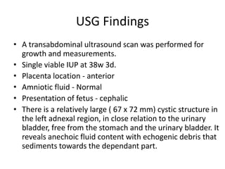 Fetal ovarian dermoid. Dr Shanti Shetty. Ultrafest 2014 | PPTX