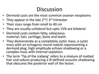 Fetal ovarian dermoid. Dr Shanti Shetty. Ultrafest 2014 | PPT