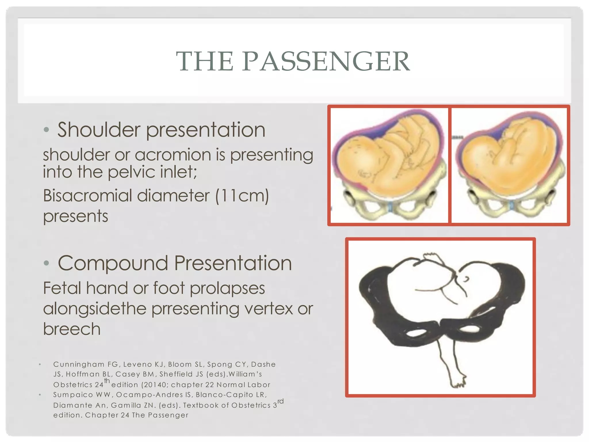 Fetal position | PDF