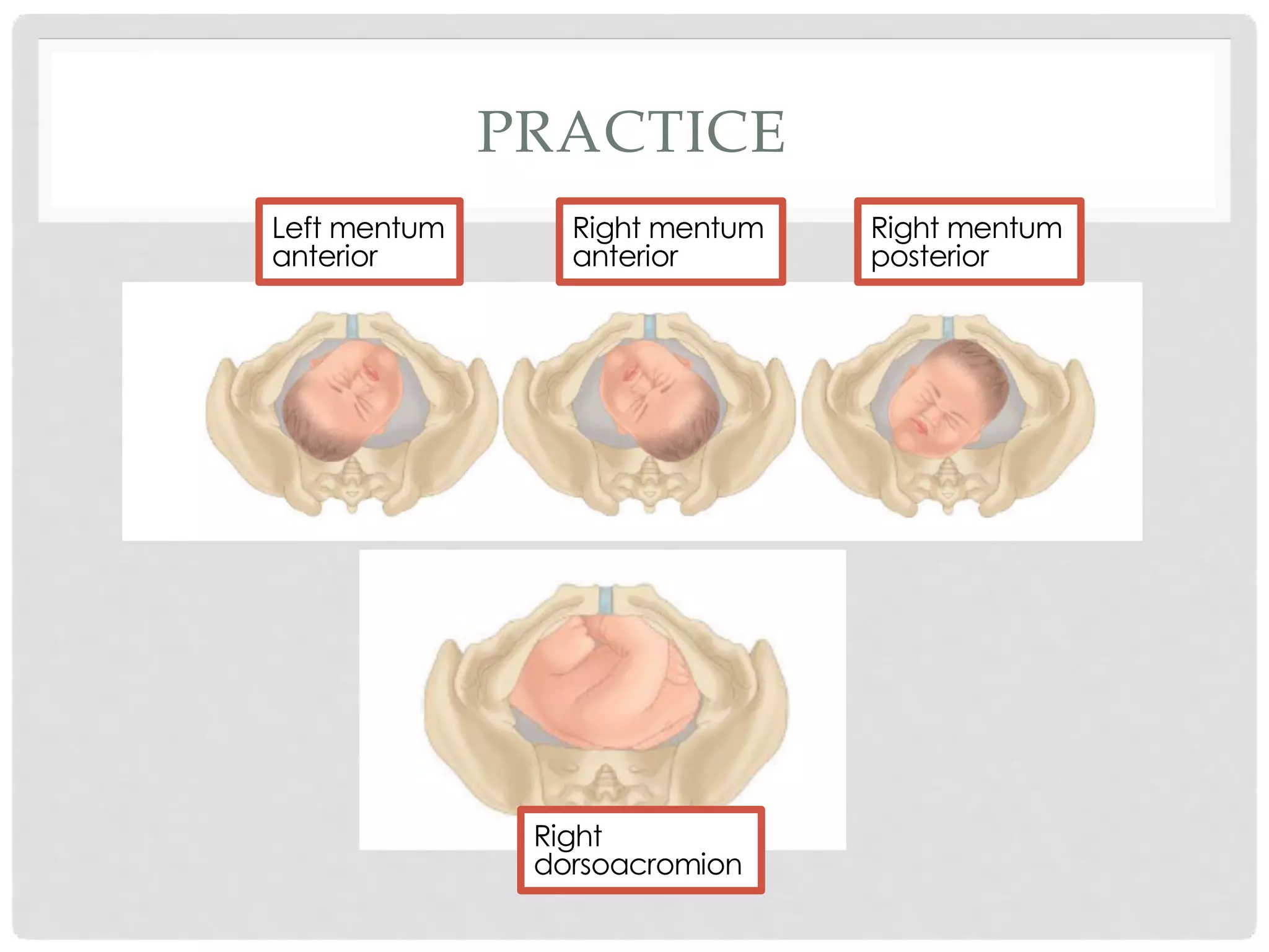 Fetal position | PDF