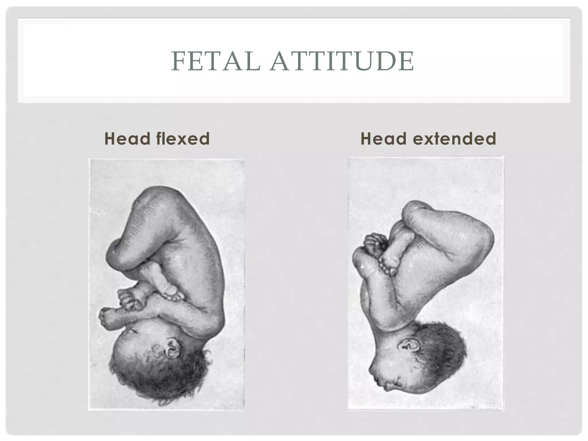 Fetal position | PDF