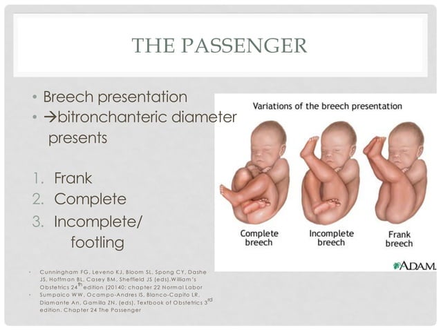 Fetal position | PDF