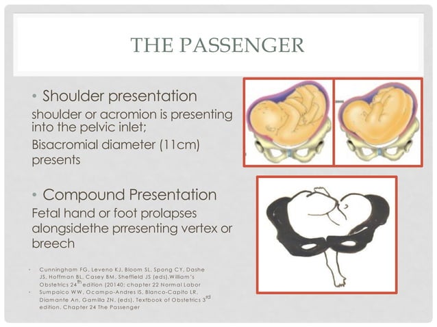 Fetal position | PDF