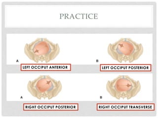 Fetal position | PDF