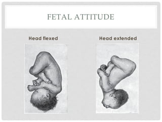 Fetal position | PDF