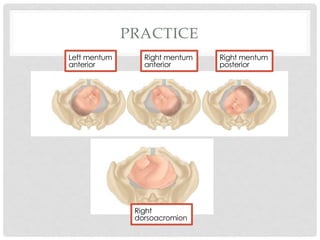 Fetal position | PPT