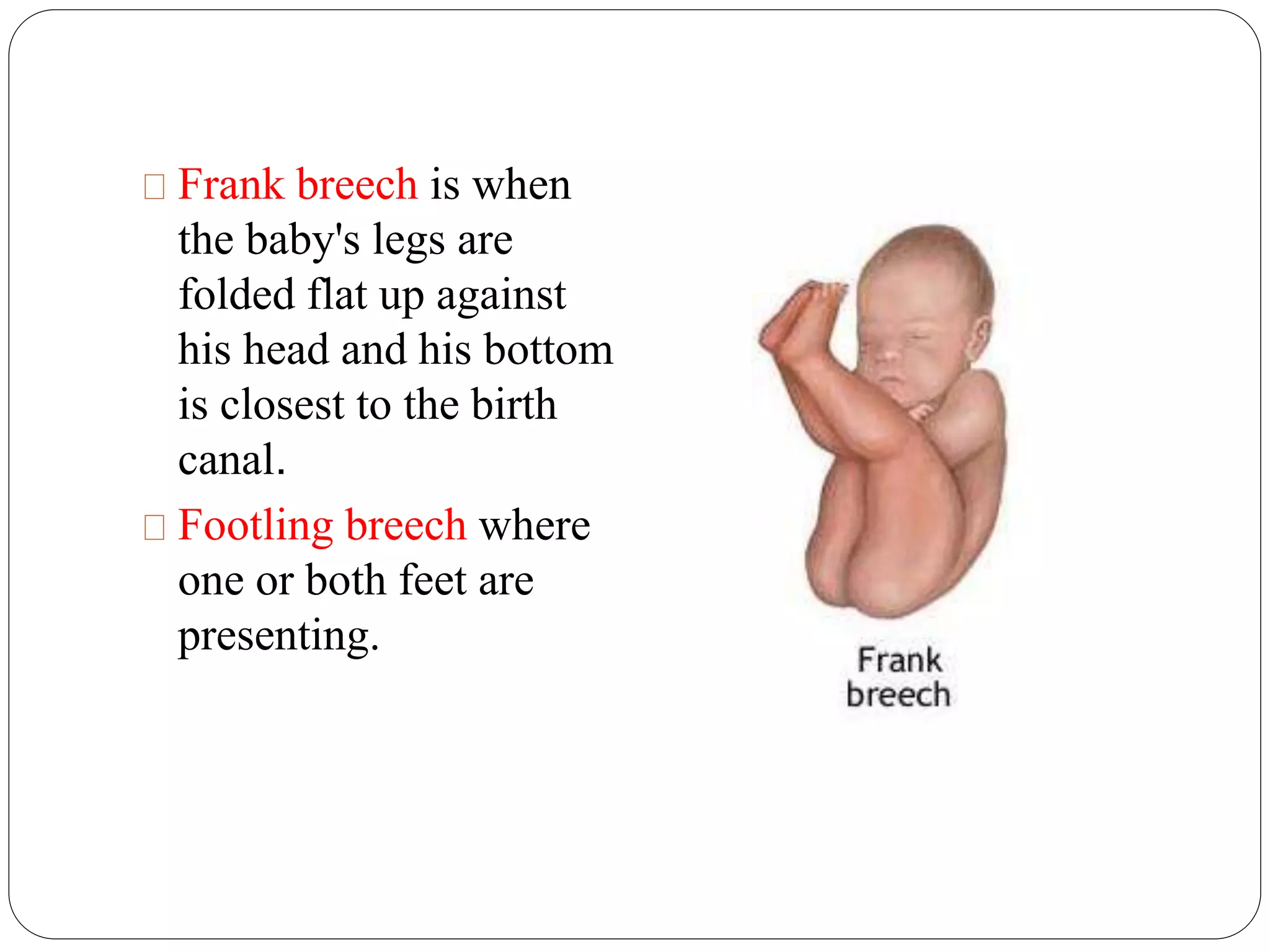 Fetal Presentation | PPTX