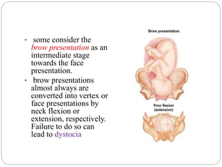 Fetal Presentation | PPTX