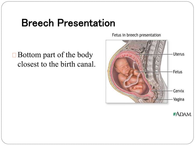 Fetal Presentation | PPTX
