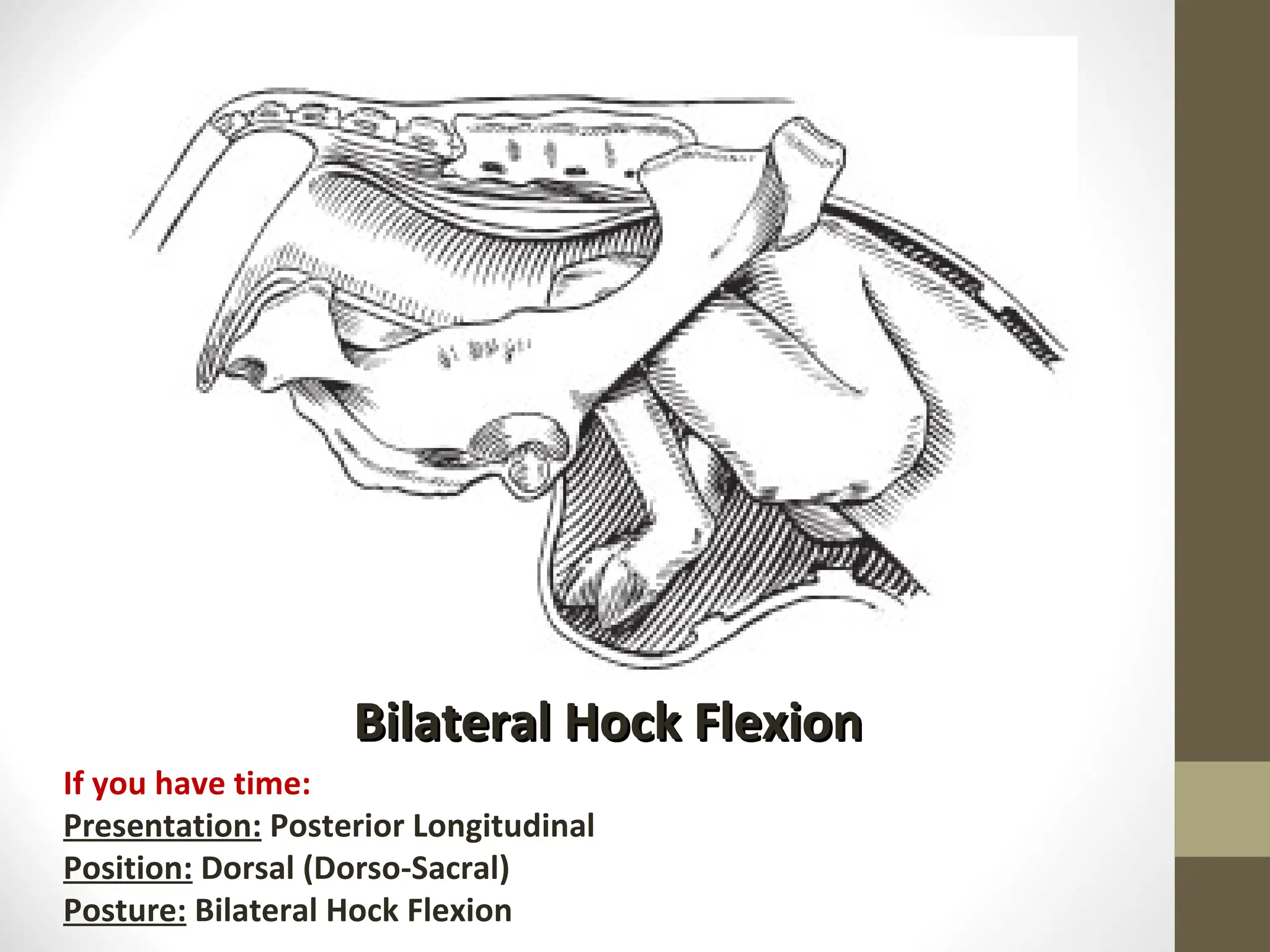fetal presentations, positions and posture. | PDF