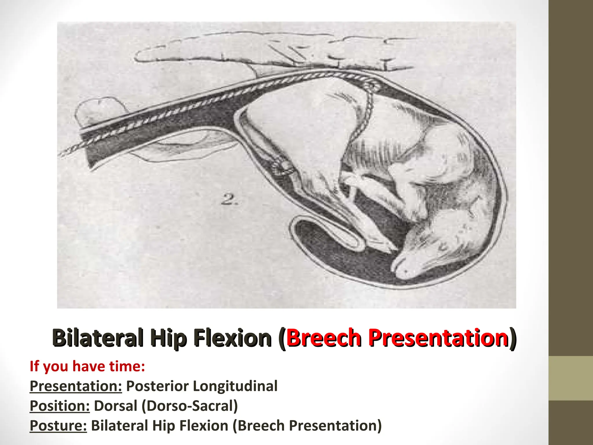 fetal presentations, positions and posture. | PDF