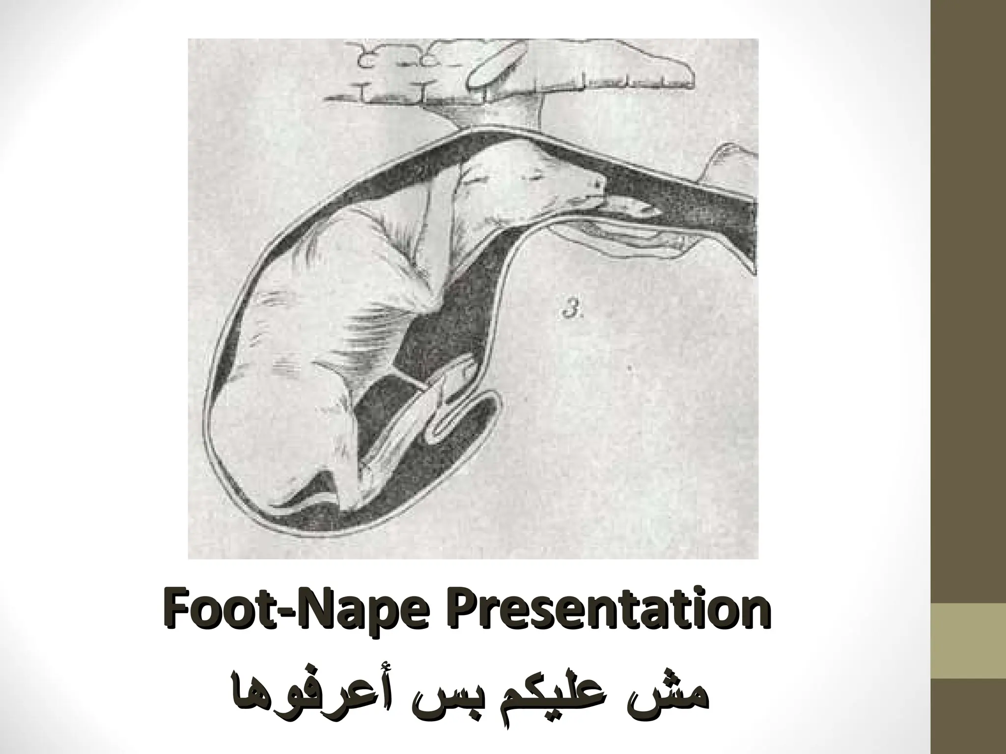 fetal presentations, positions and posture. | PDF