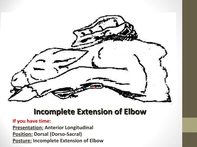 fetal presentations, positions and posture. | PDF