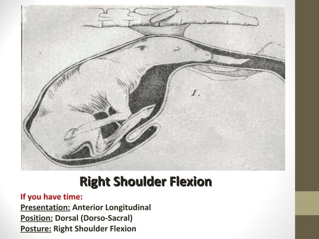 fetal presentations, positions and posture. | PDF