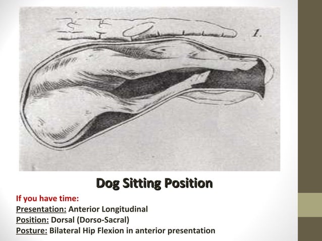 fetal presentations, positions and posture. | PDF