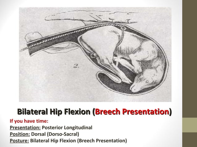 fetal presentations, positions and posture. | PDF