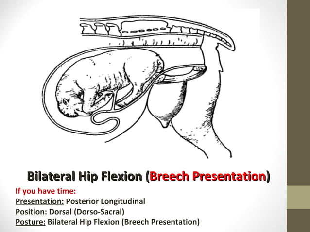 fetal presentations, positions and posture. | PDF