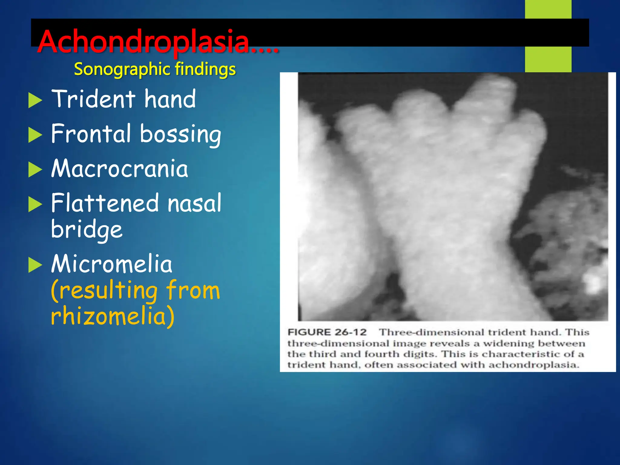FETAL SKELETAL ANOMALIES GROUP 3.pptx