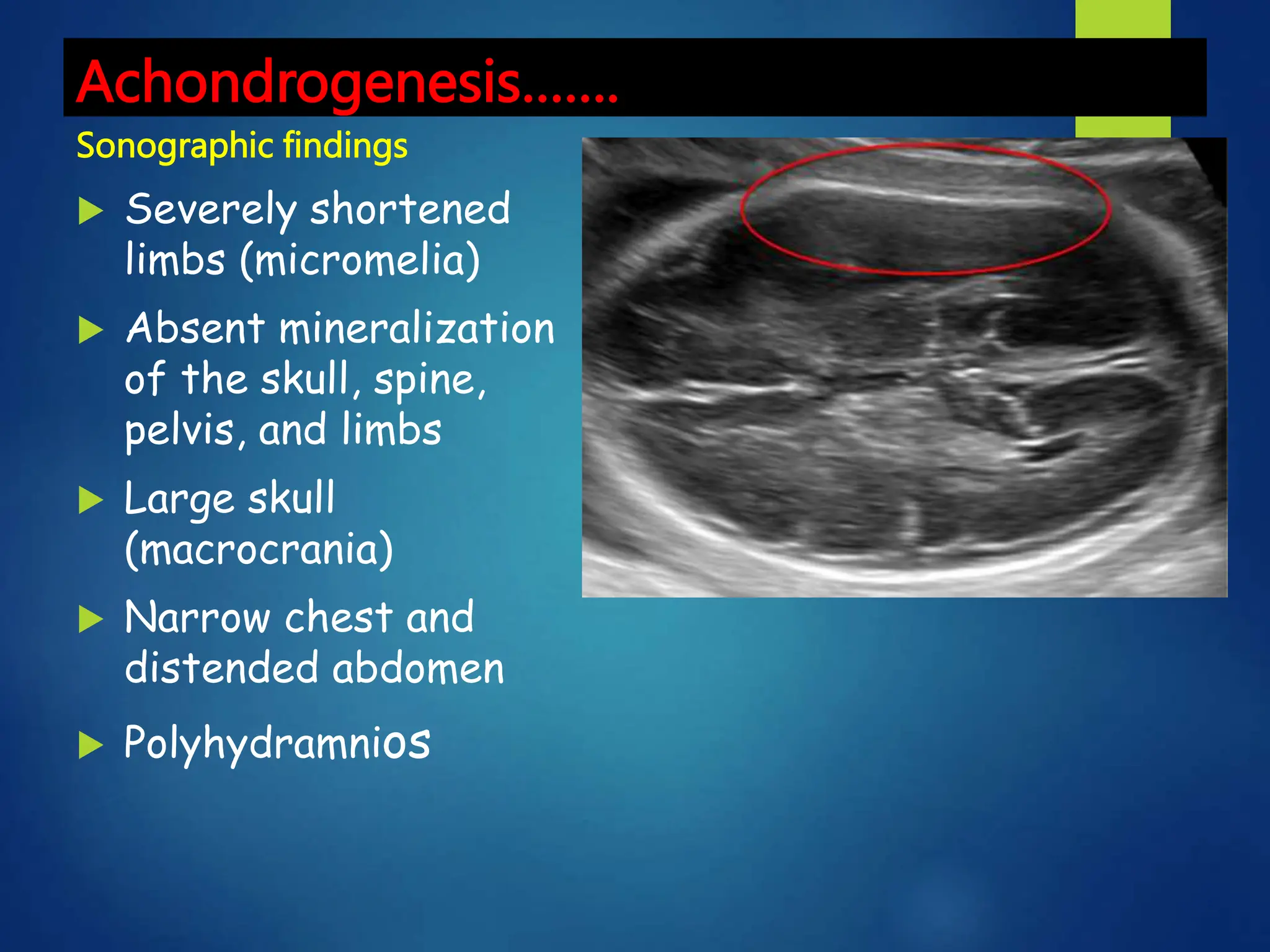 FETAL SKELETAL ANOMALIES GROUP 3.pptx