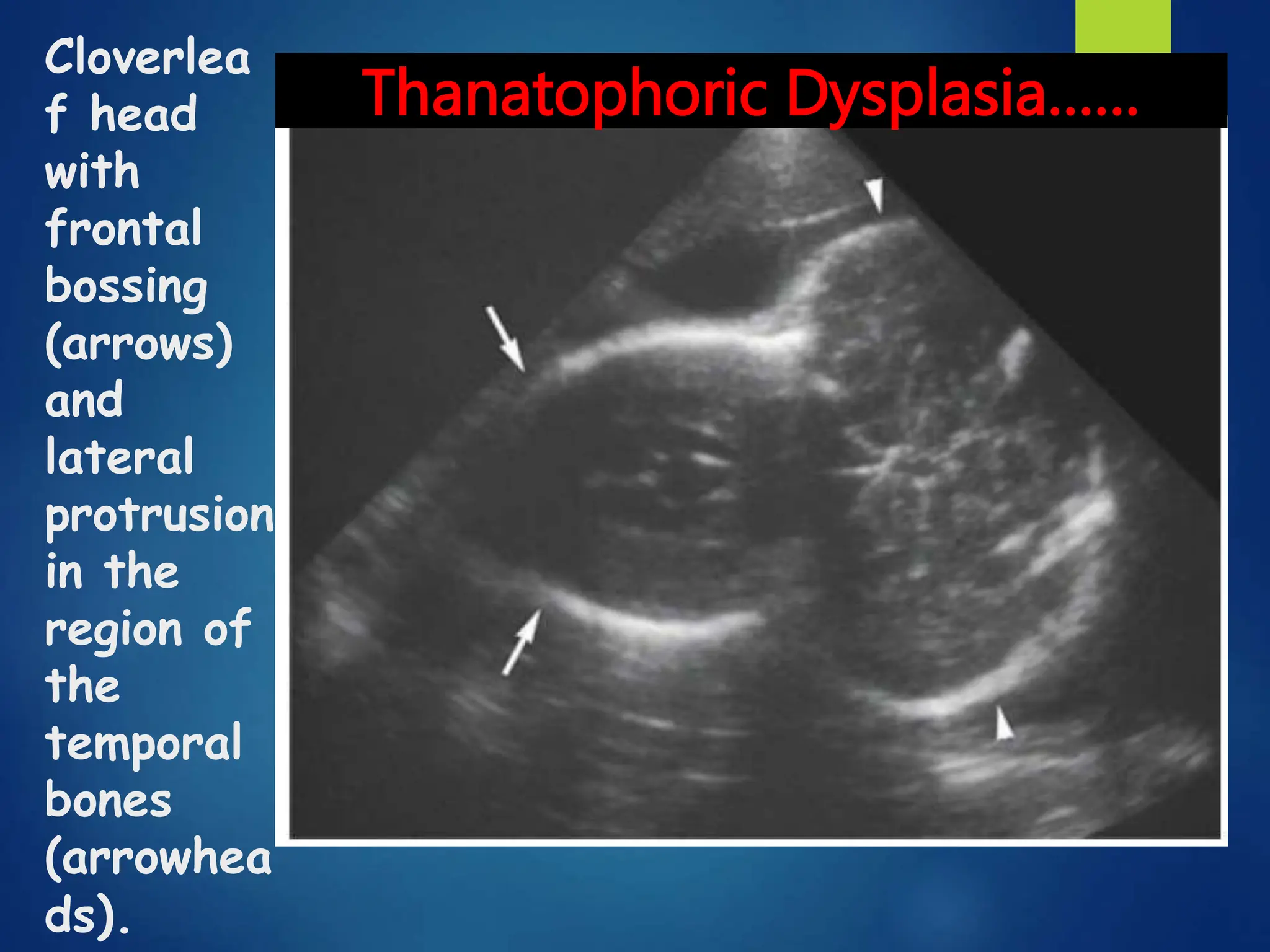 FETAL SKELETAL ANOMALIES GROUP 3.pptx