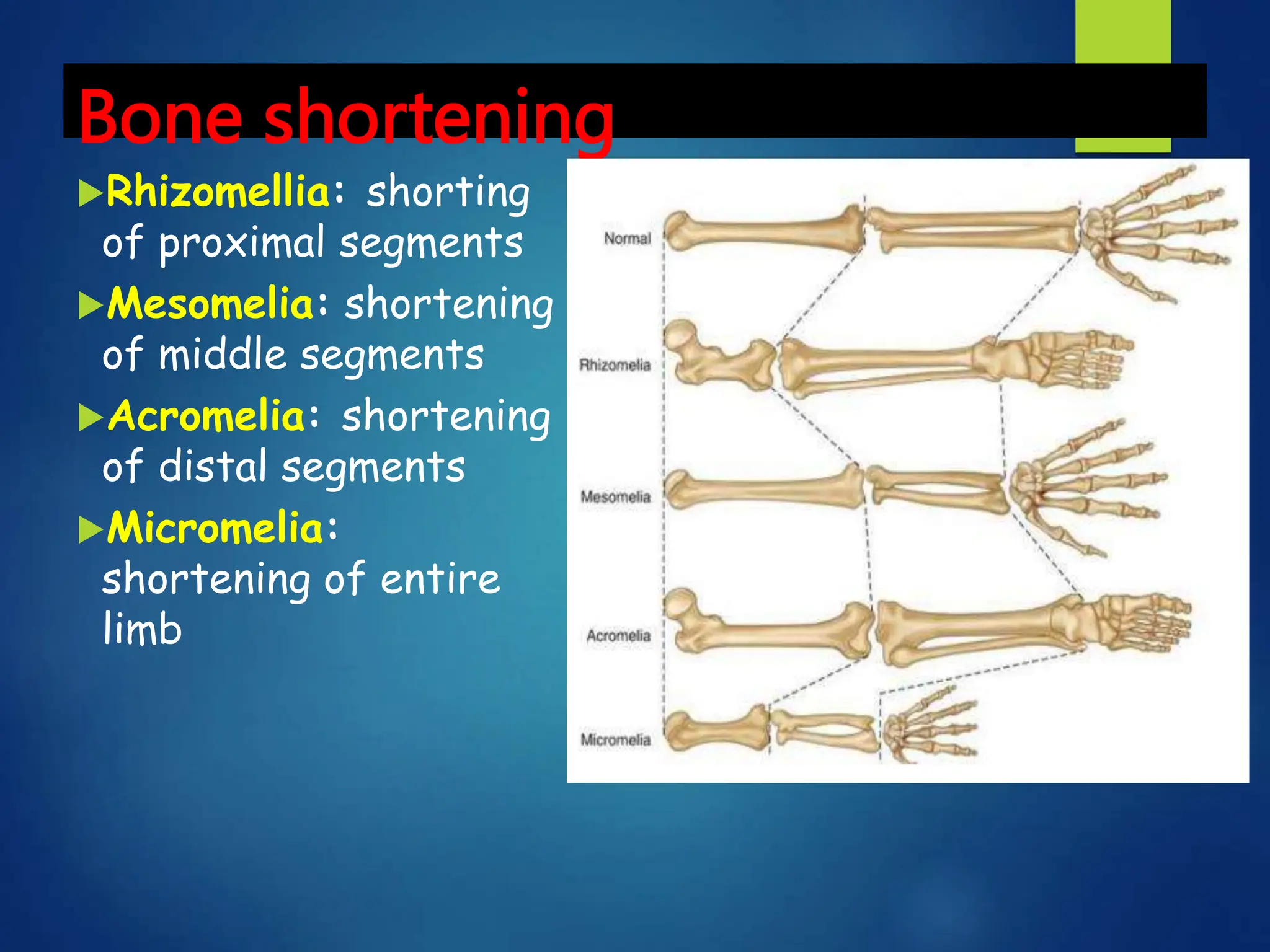 FETAL SKELETAL ANOMALIES GROUP 3.pptx
