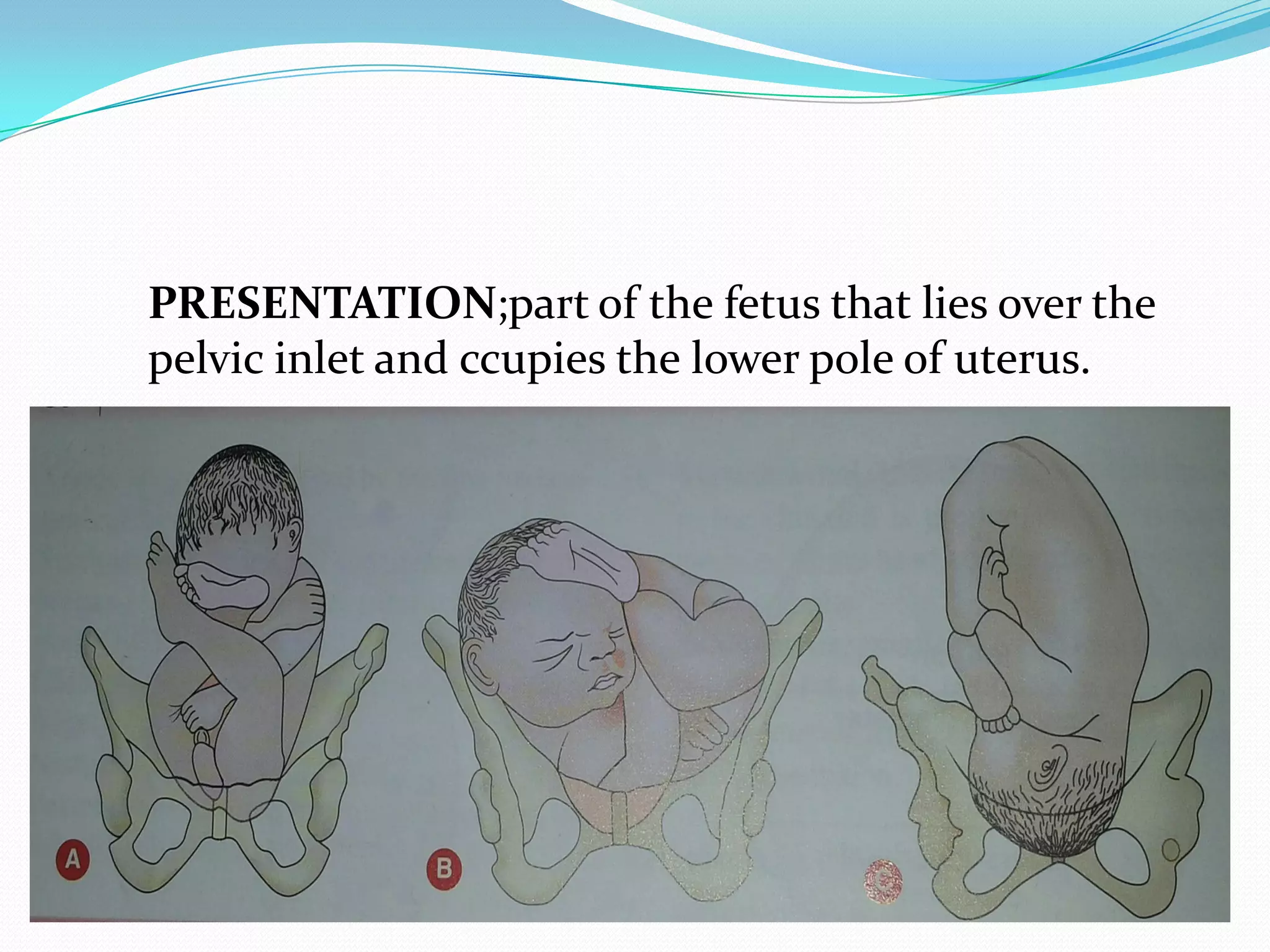 Fetal skull | PDF