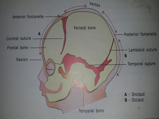 Fetal skull | PPT