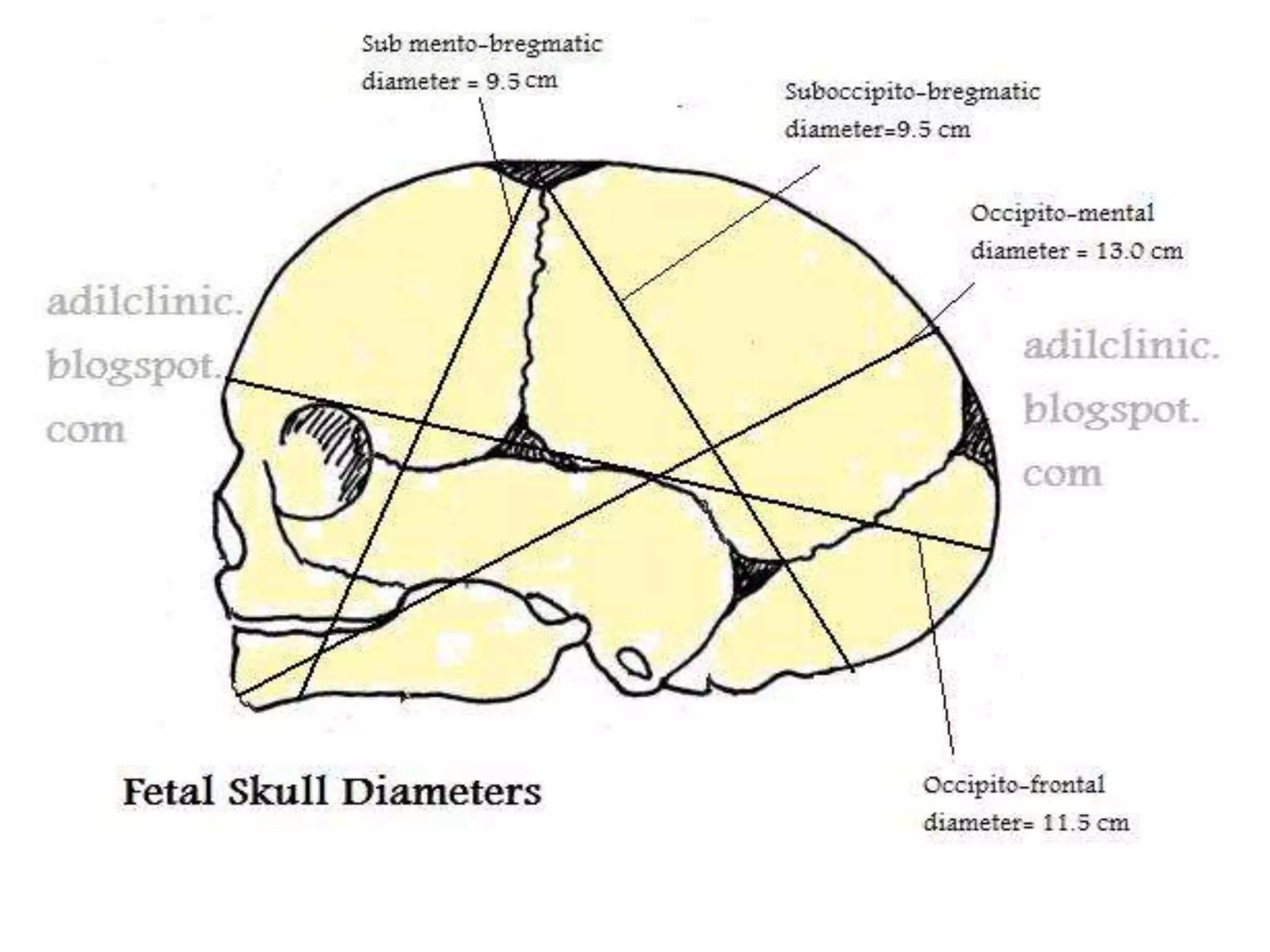 Fetal skull | PPTX