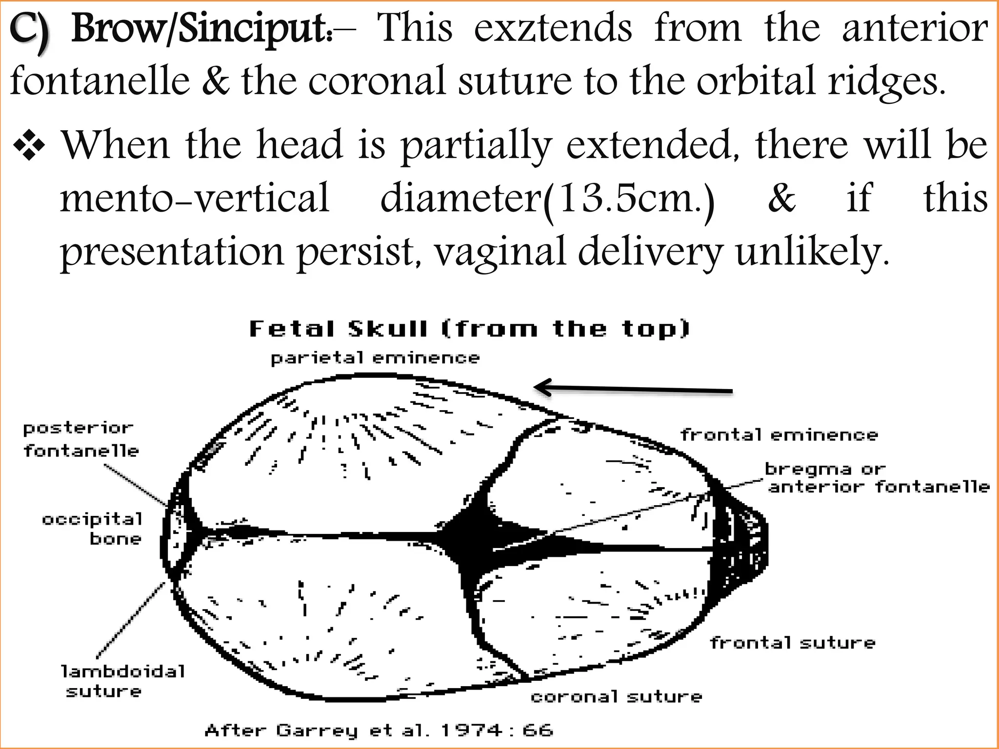 Fetal skull | PPTX