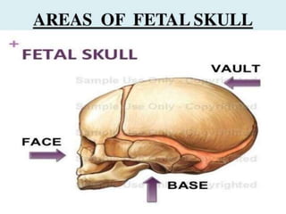 Fetal skull | PPTX | Pregnancy | Reproductive Health