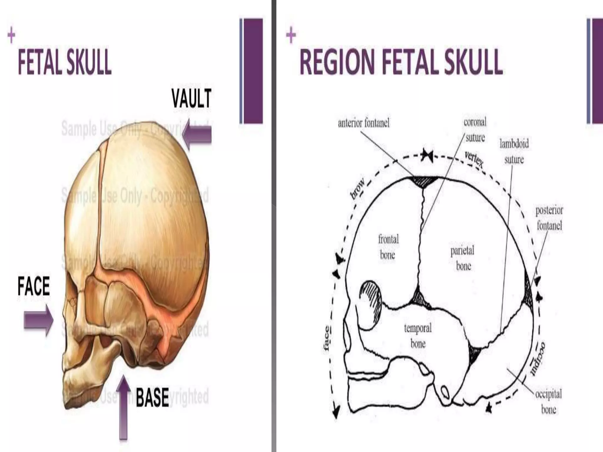 Fetal skull | PPTX