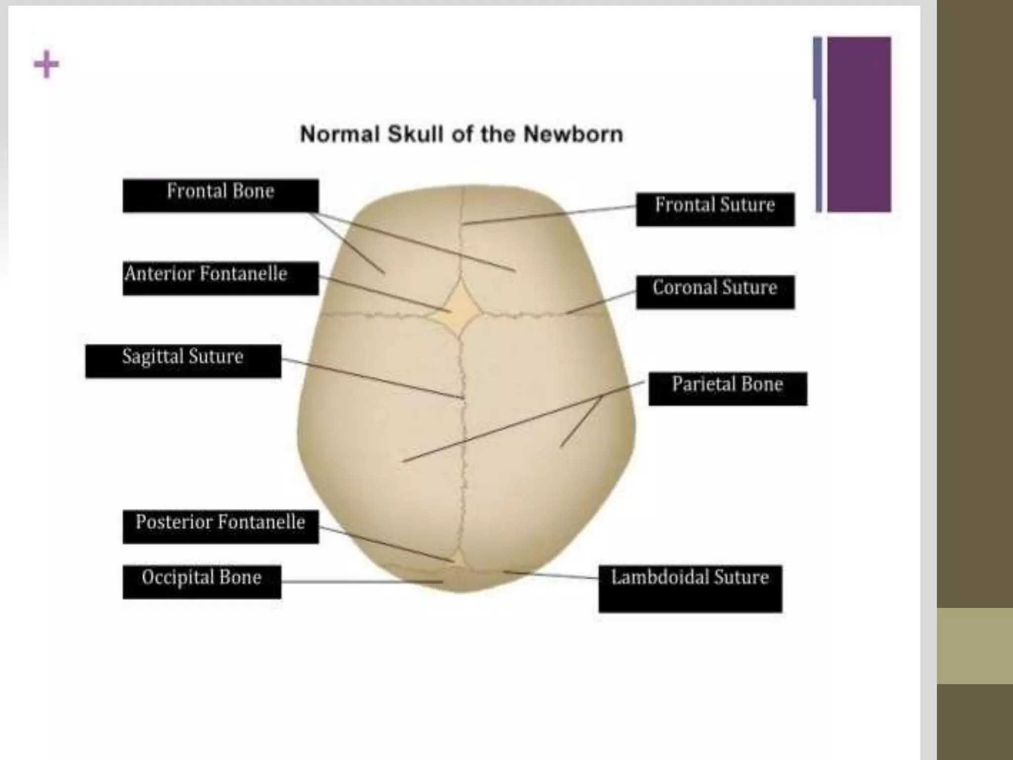 Fetal skull | PDF